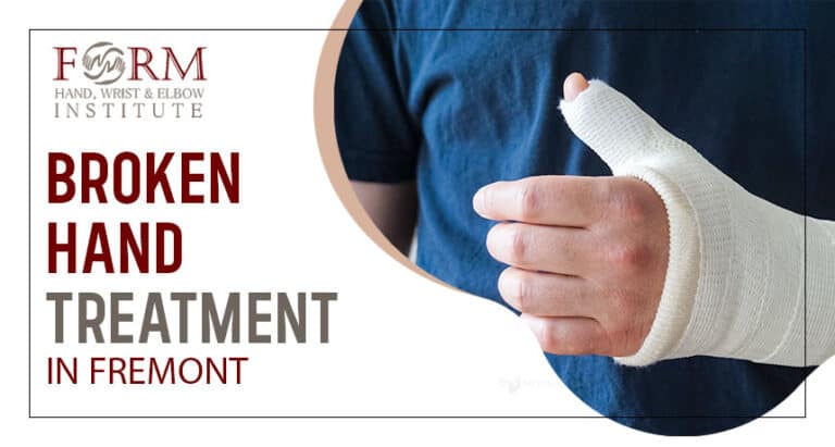 Broken Hand Treatment in Fremont | FORM Hand, Wrist & Elbow Institute